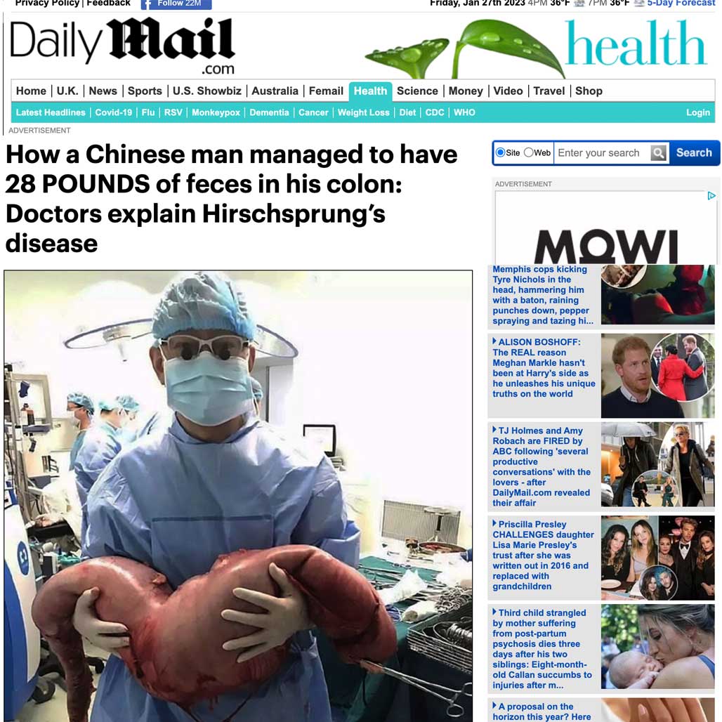 Constipation: This Man Lived With It For 3 Years